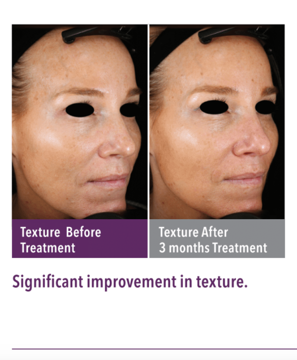 Skin Health System - SkinGenuity